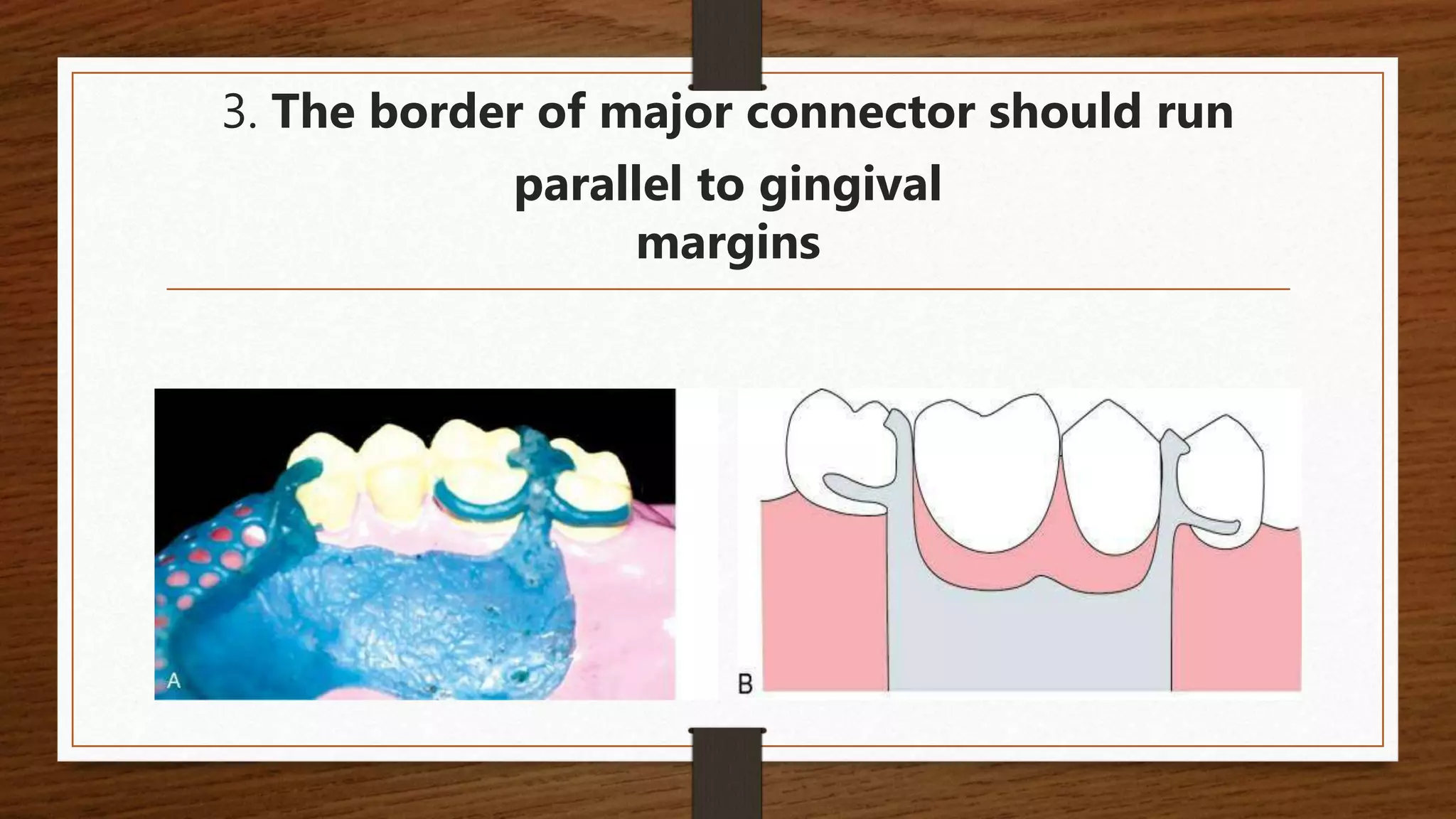 Major and minor connectors | PPTX