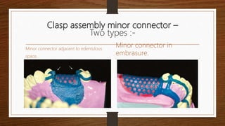 Major and minor connectors | PPTX
