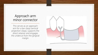 Major and minor connectors | PPTX