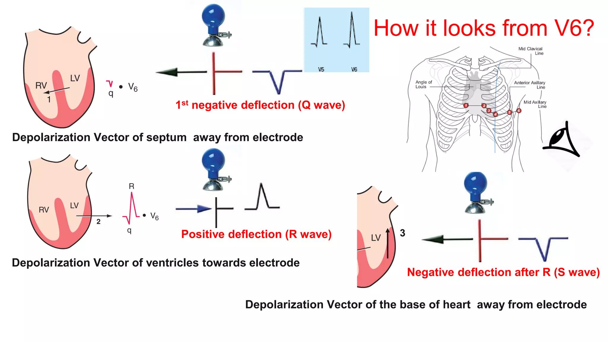 ECG made easy | PDF