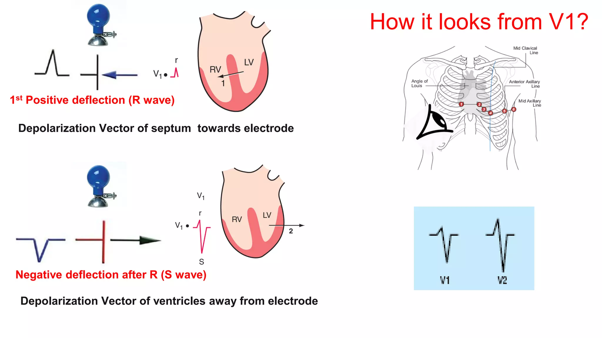 ECG made easy | PDF