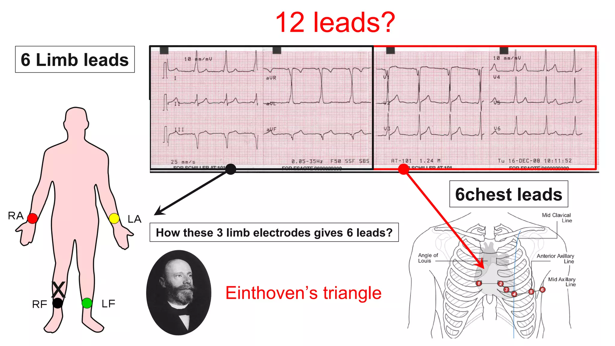 ECG made easy | PDF