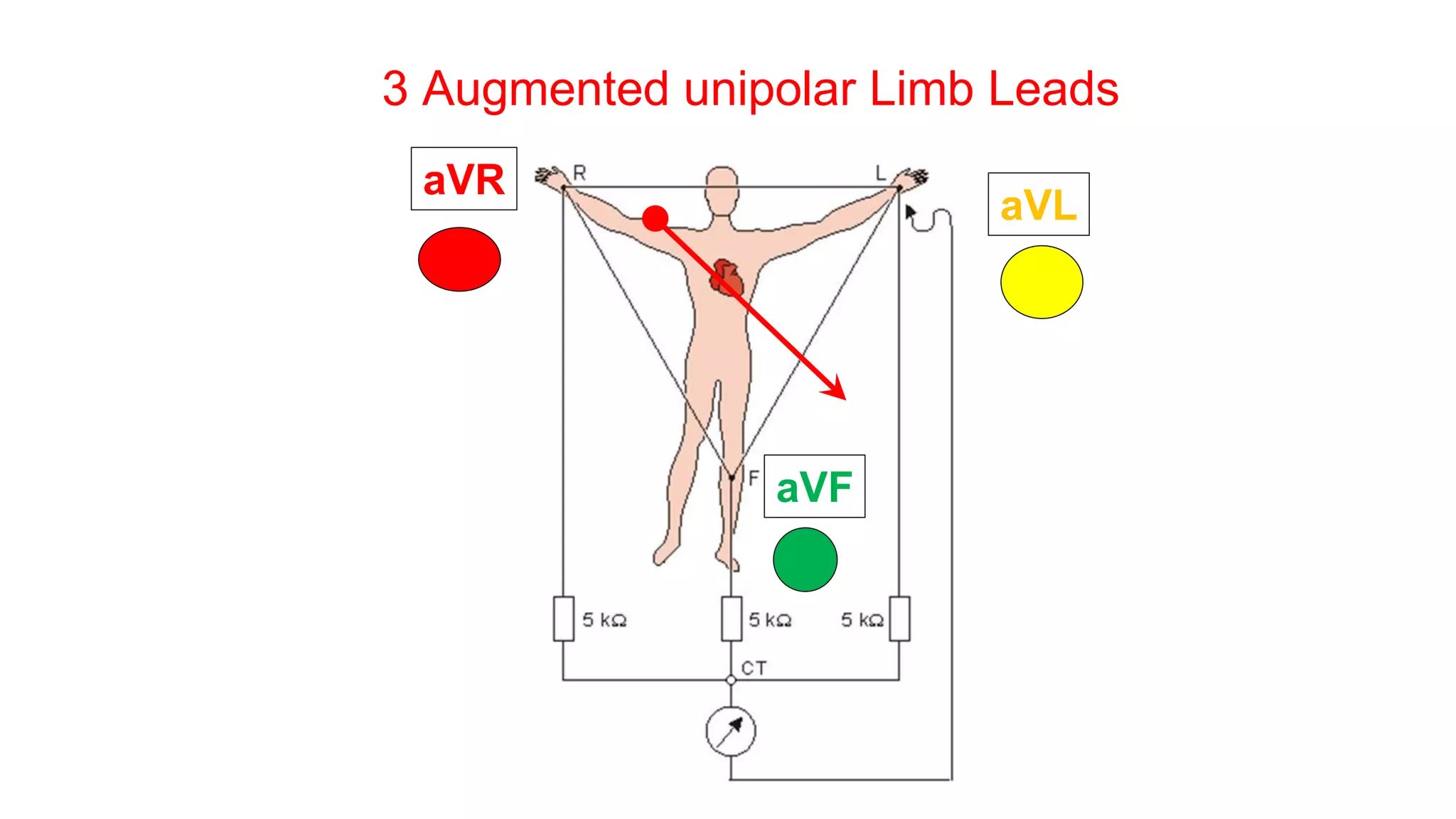 ECG made easy | PDF