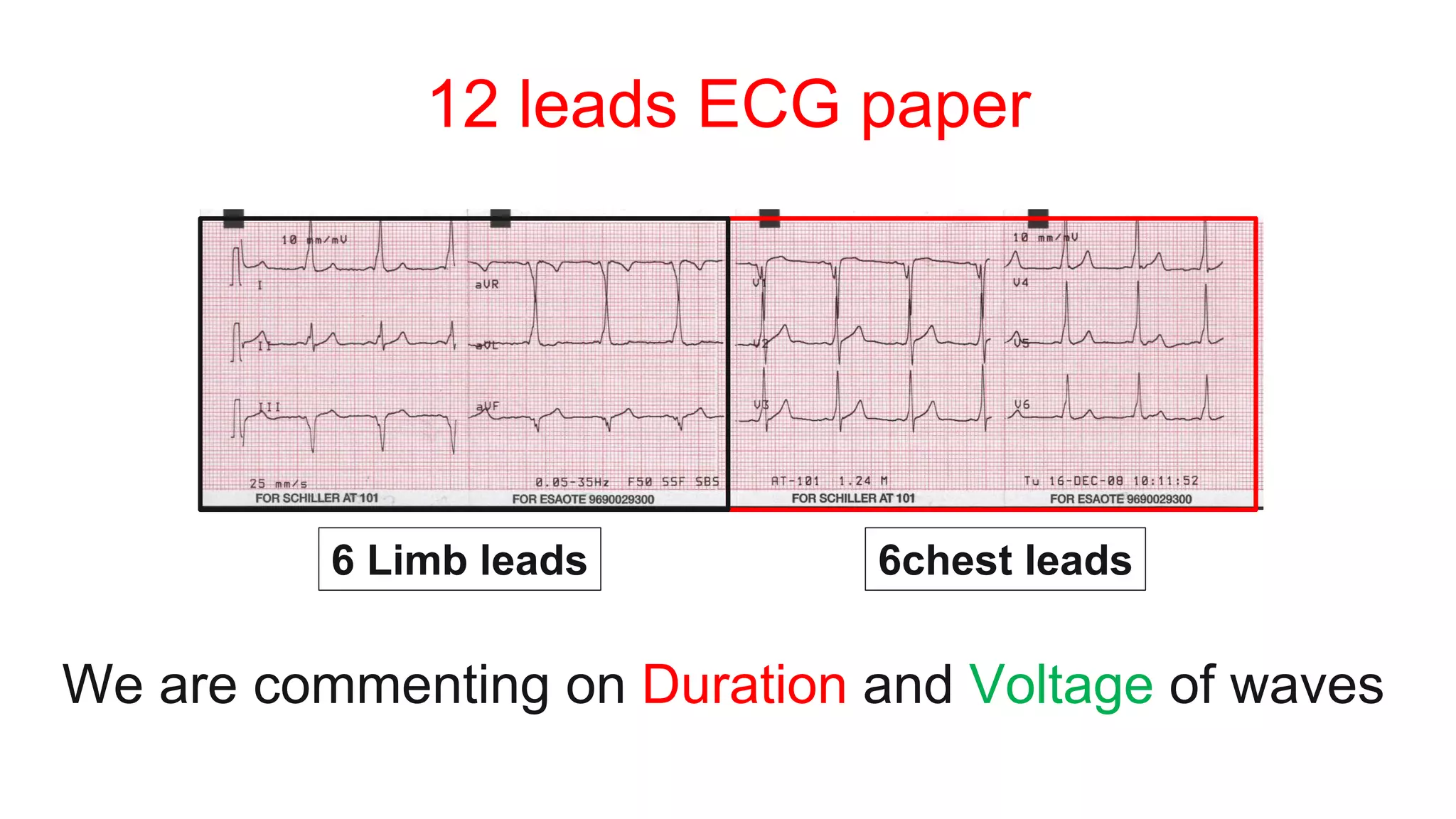 ECG made easy | PDF