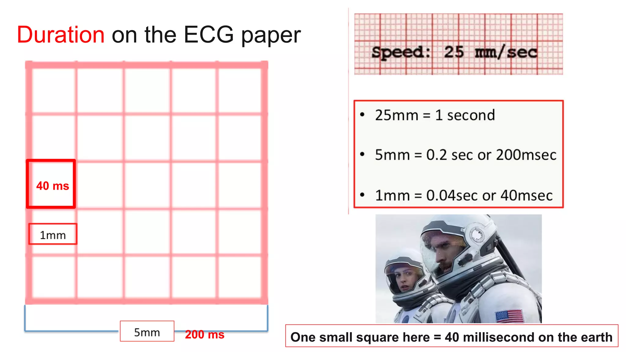 ECG made easy | PDF