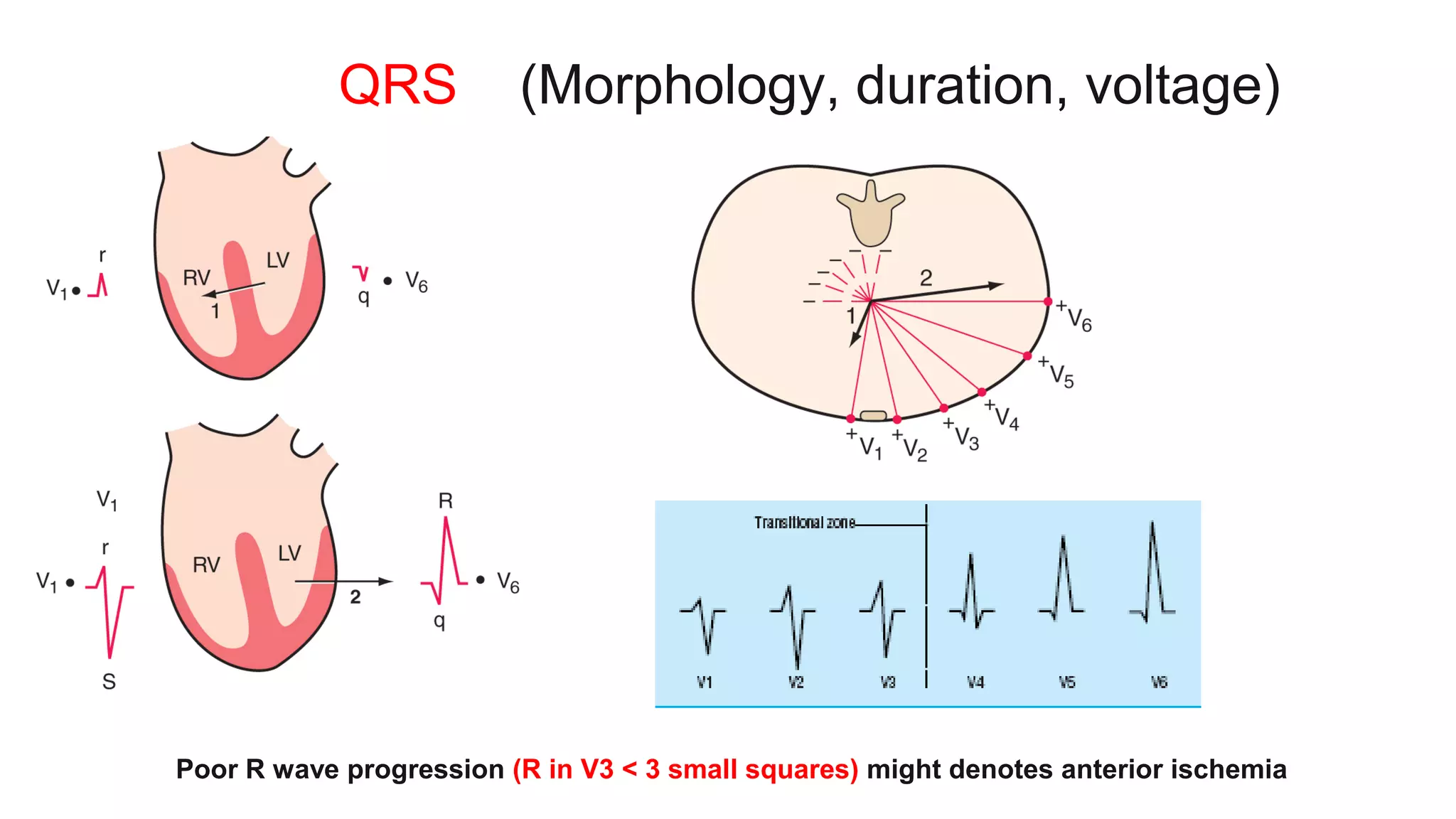 ECG made easy | PDF