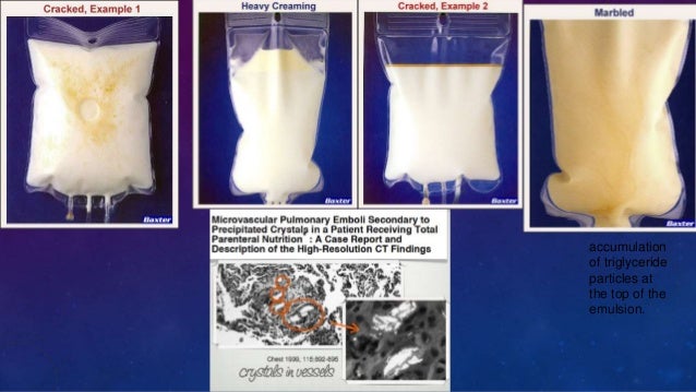 Incompatibilities of drug admixtures