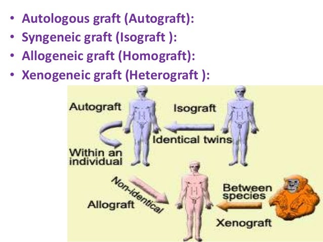 Organ transplantation immunology basics