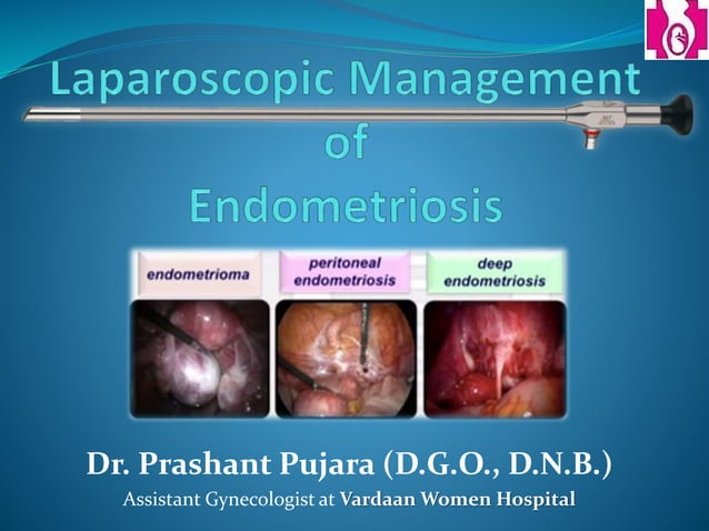 Laparoscopic management of endometriosis | PPTX