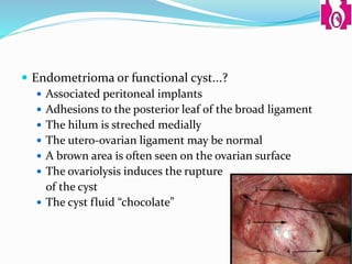 Laparoscopic management of endometriosis | PPTX