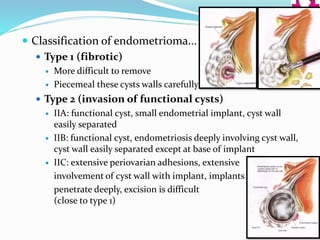 Laparoscopic management of endometriosis | PPTX