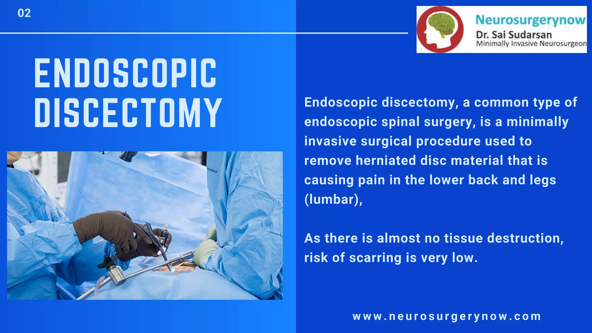 Endoscopic lumbar discectomy | PDF