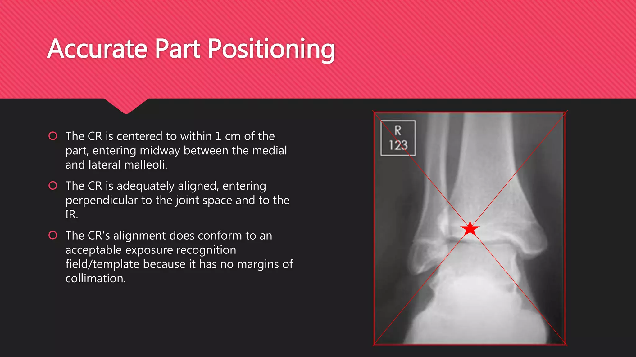 Final Image Evaluation - AP Ankle | PPT
