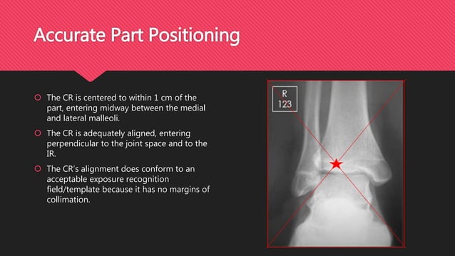 Final Image Evaluation - AP Ankle | PPT