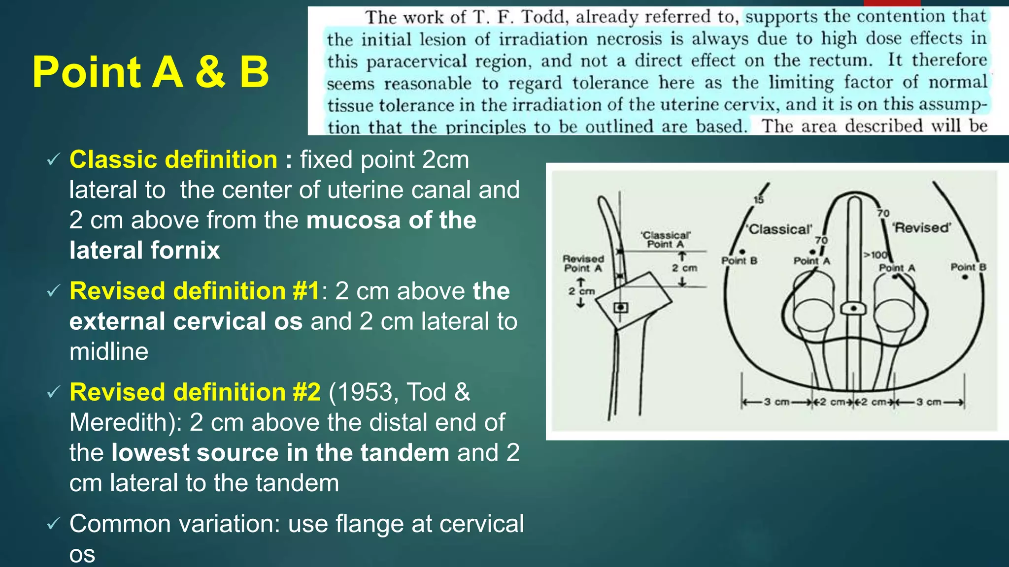 Evolution of Intracavitary brachytherapy for carcinoma of cervix | PPTX