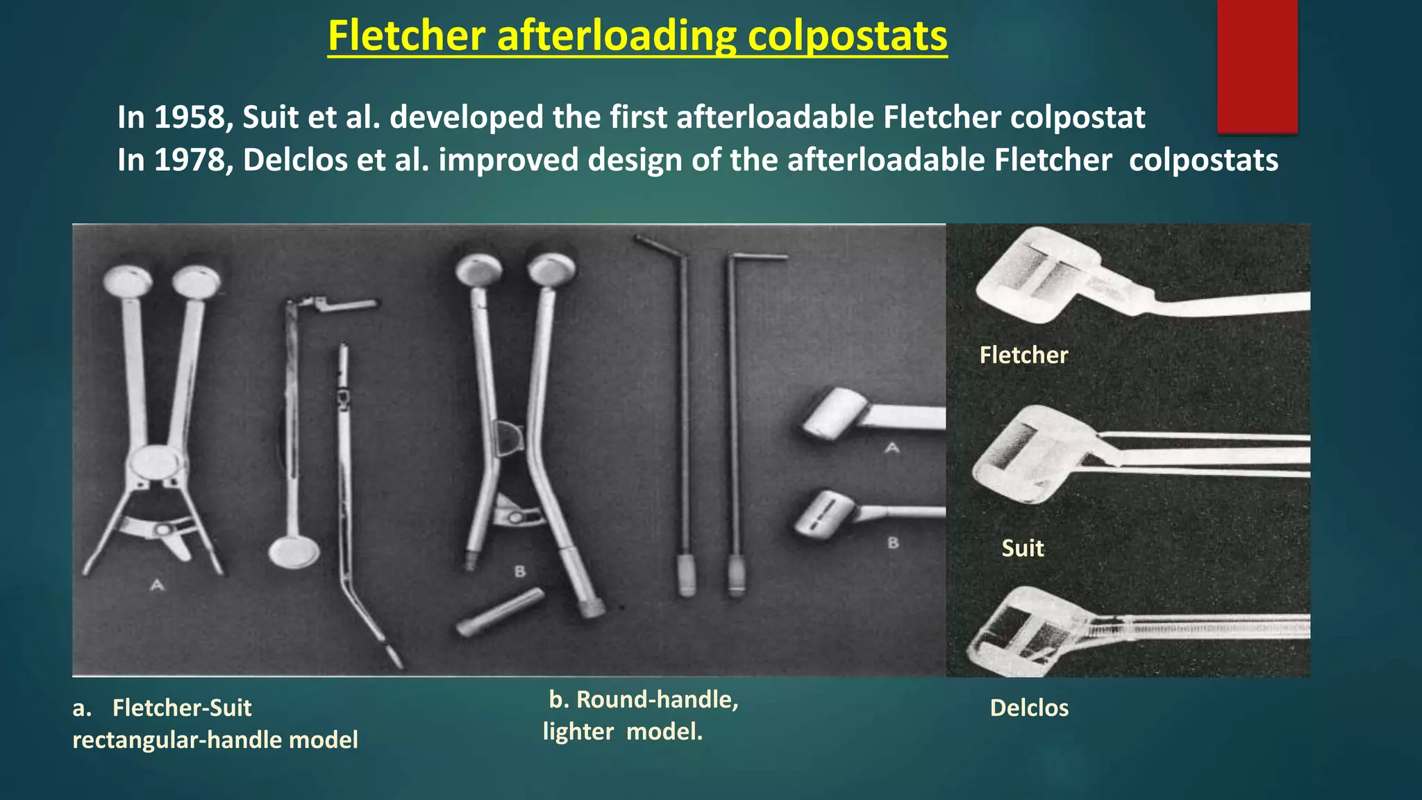 Evolution of Intracavitary brachytherapy for carcinoma of cervix | PPTX