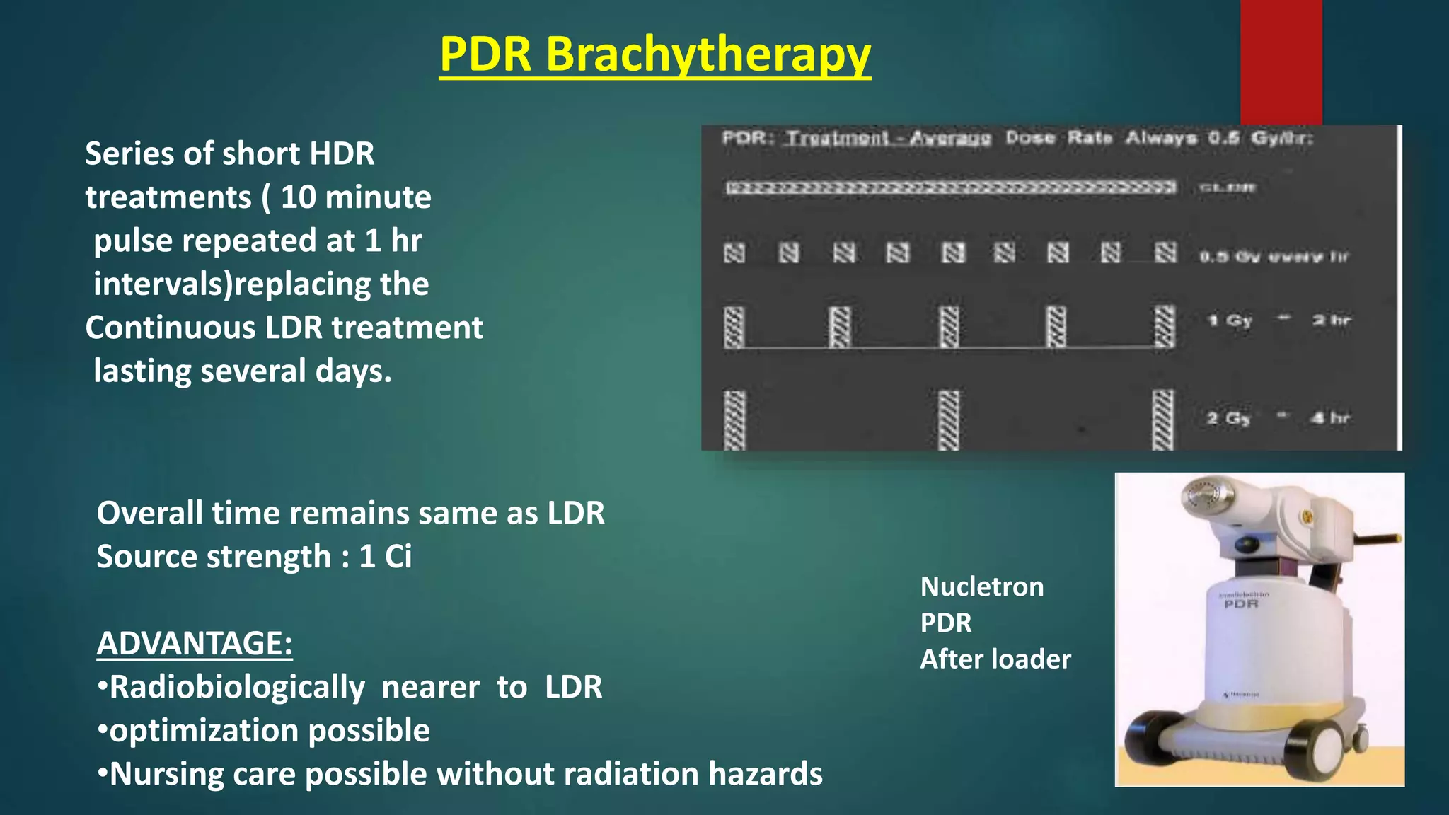 Evolution of Intracavitary brachytherapy for carcinoma of cervix | PPTX