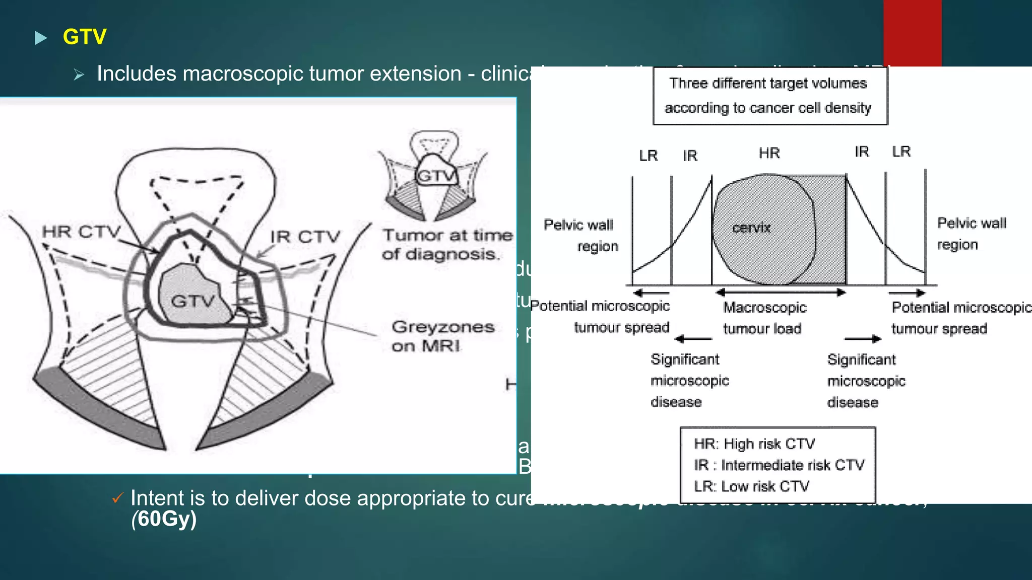Evolution of Intracavitary brachytherapy for carcinoma of cervix | PPTX