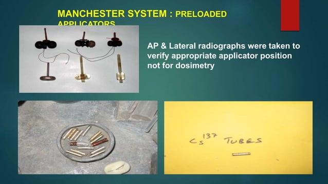 Evolution of Intracavitary brachytherapy for carcinoma of cervix | PPTX ...