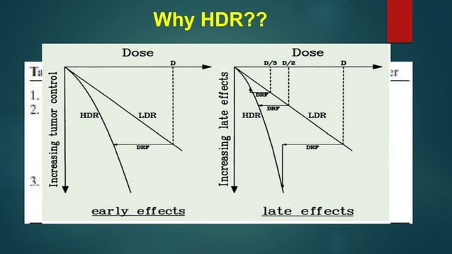 Evolution of Intracavitary brachytherapy for carcinoma of cervix | PPTX ...
