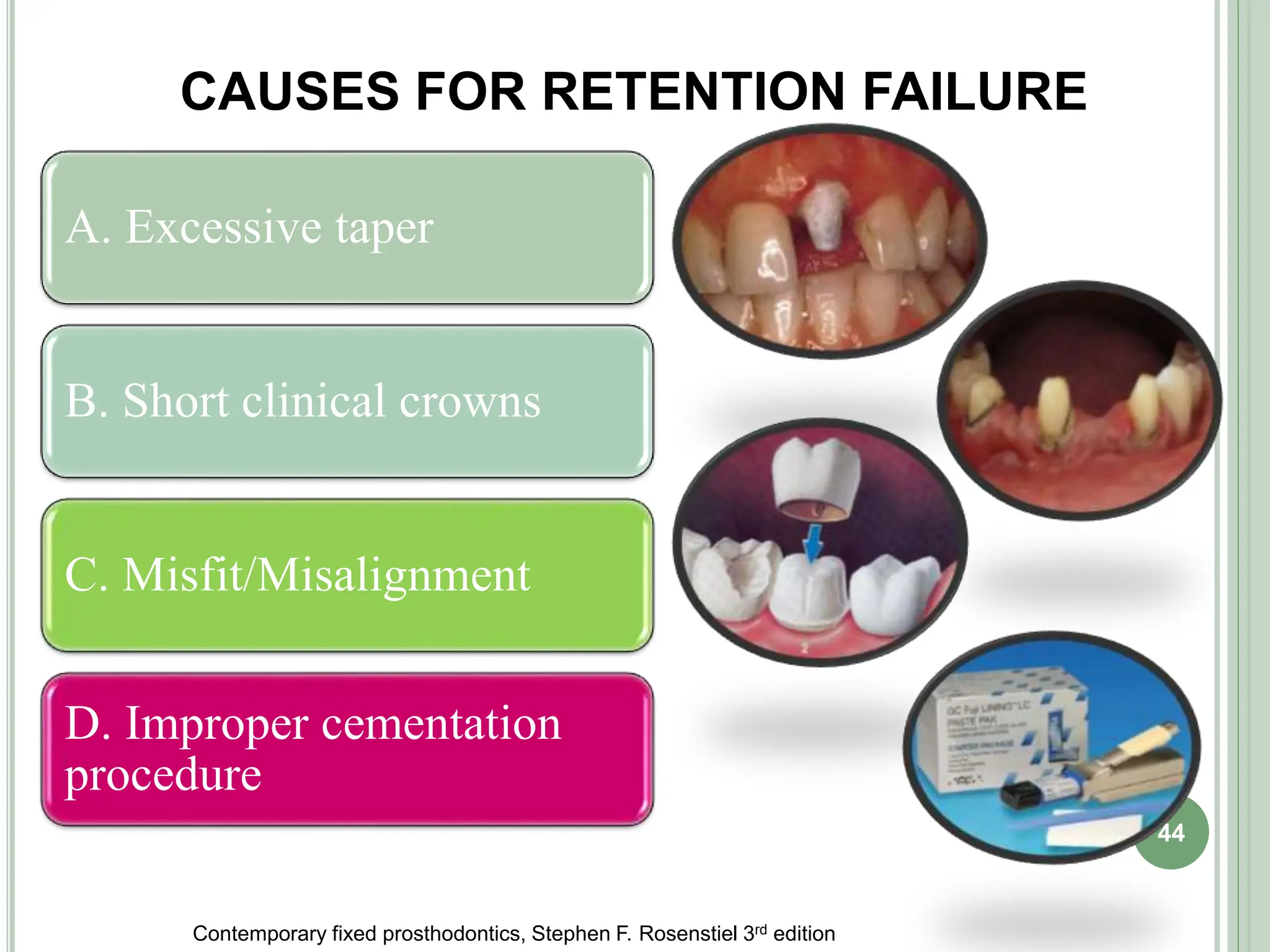 Final failures in fixed partial denture Richa.pptx