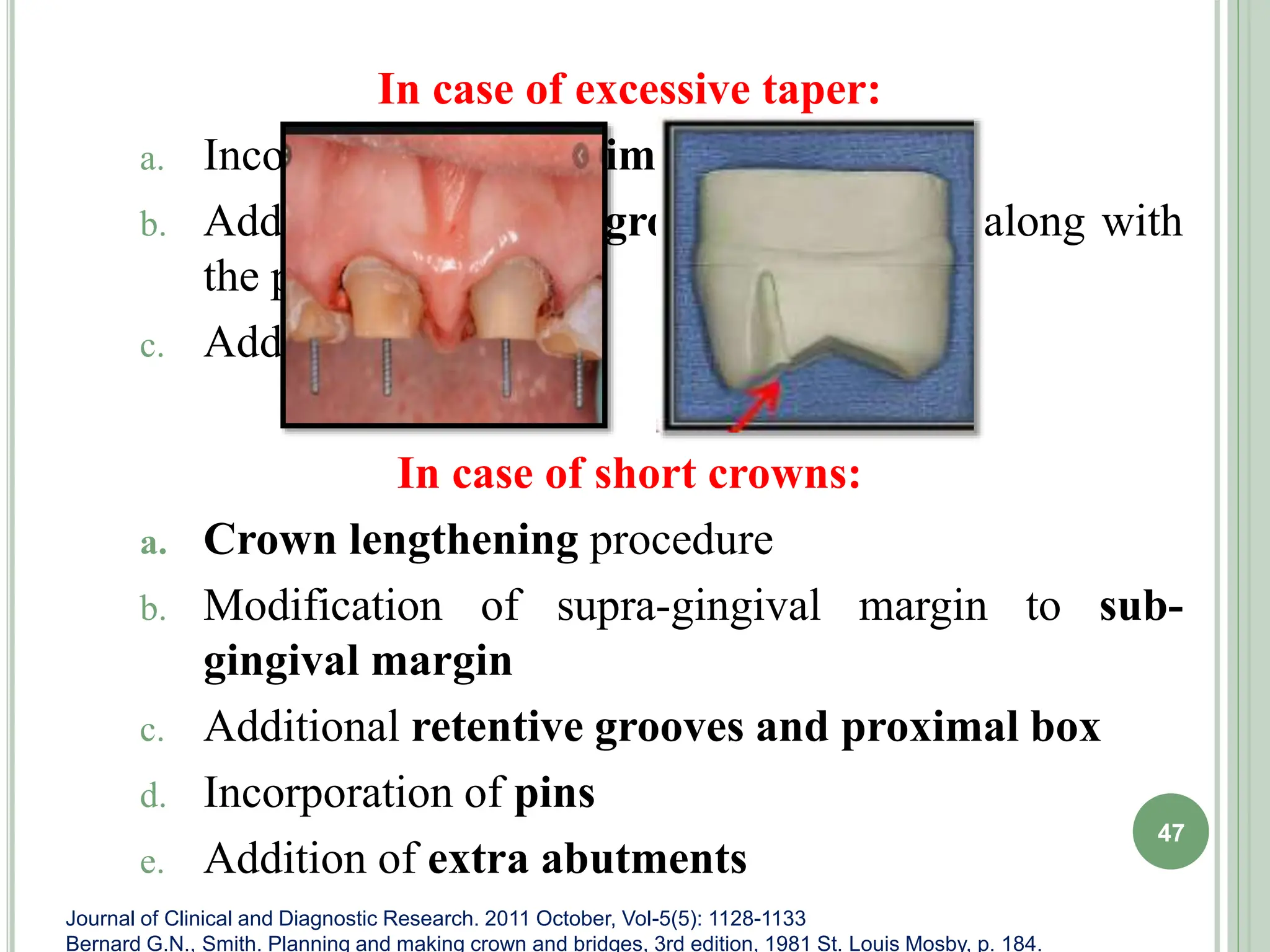 Final failures in fixed partial denture Richa.pptx