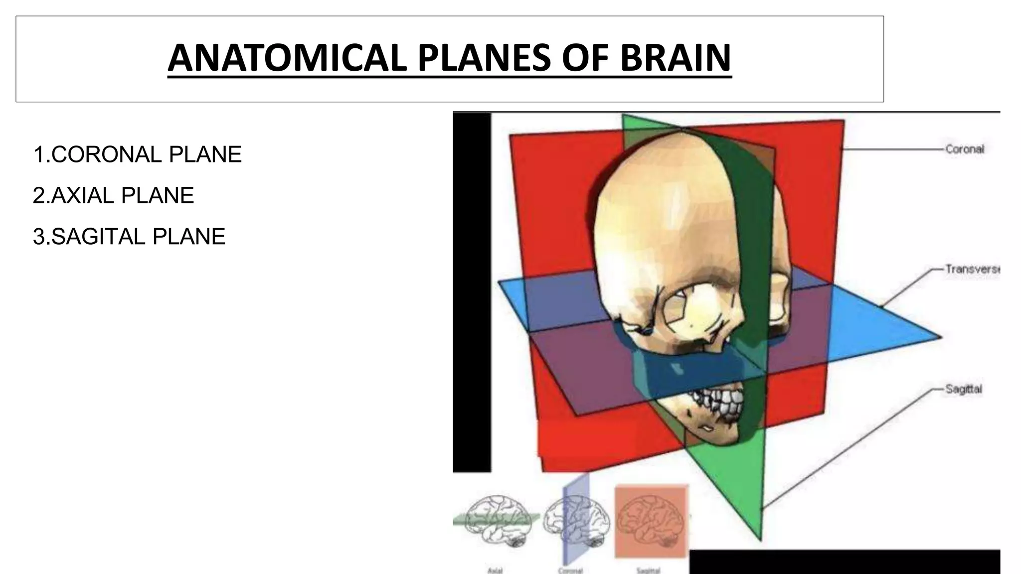 Radiological anatomy of brain | PPTX