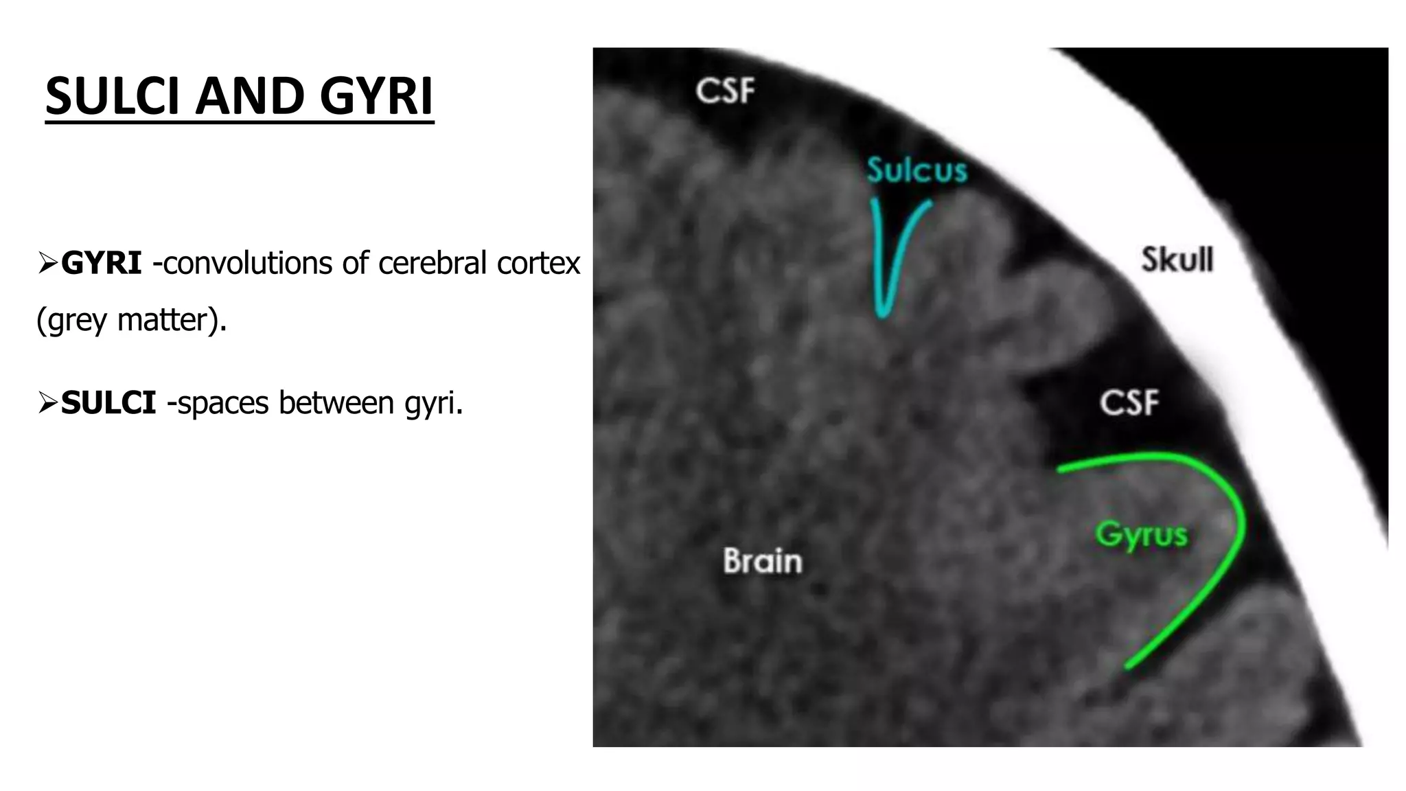 Radiological anatomy of brain | PPTX
