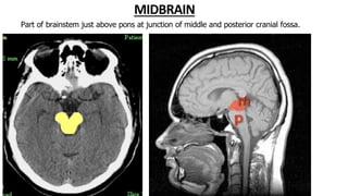 Radiological anatomy of brain | PPTX