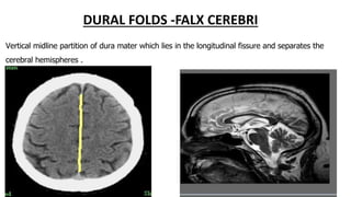 Radiological anatomy of brain | PPTX