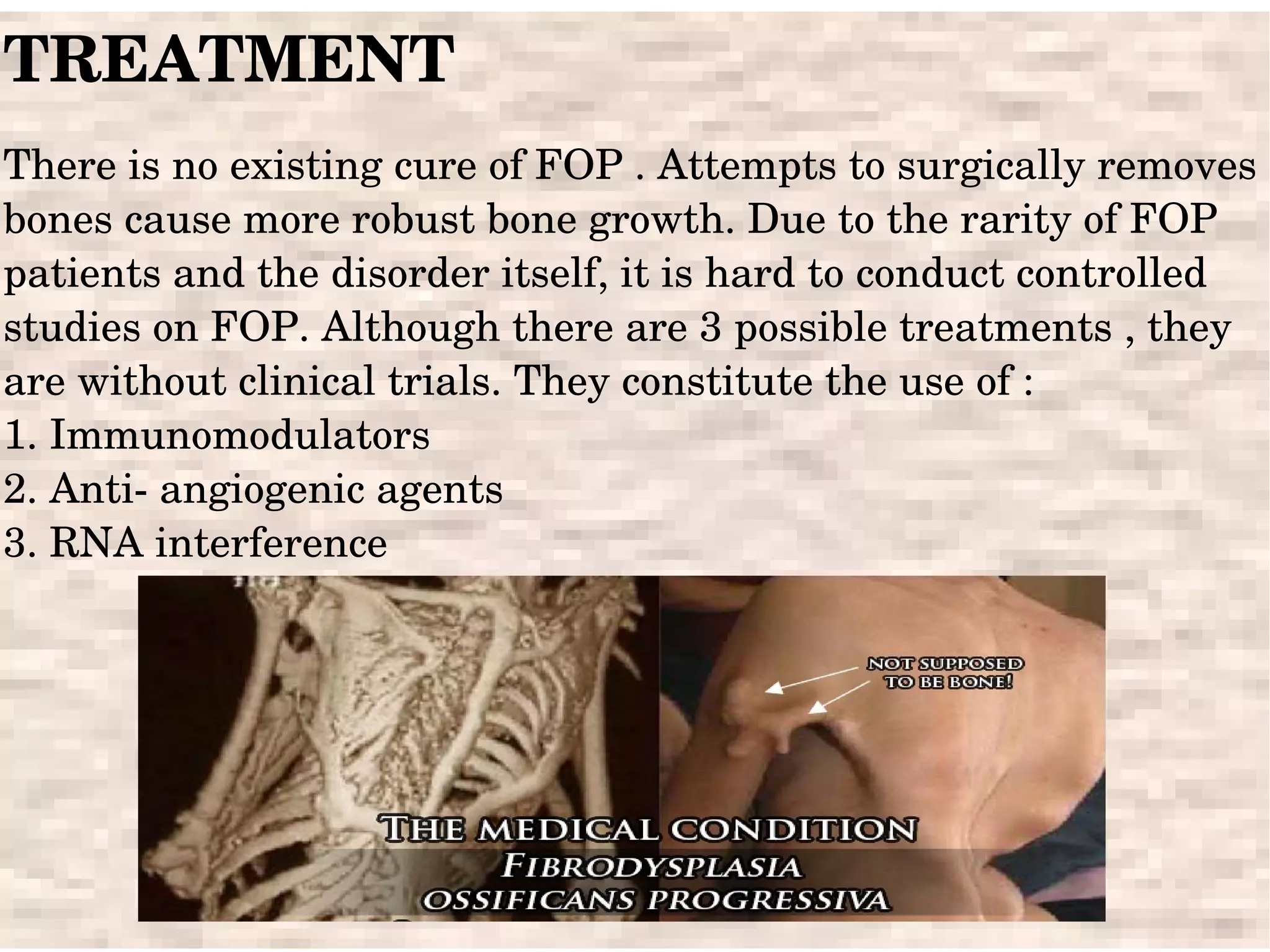 Fibrodysplasia ossificans progressiva | PDF