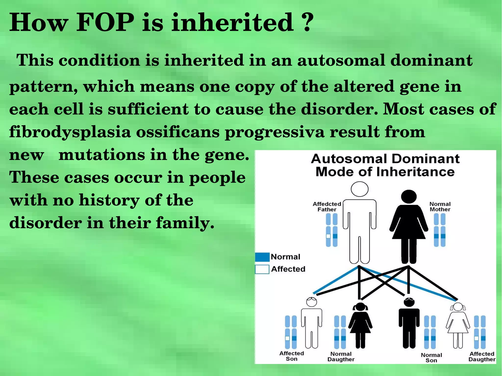 Fibrodysplasia ossificans progressiva | PDF