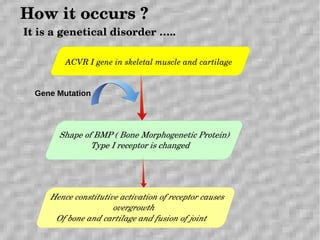 Fibrodysplasia ossificans progressiva | PDF