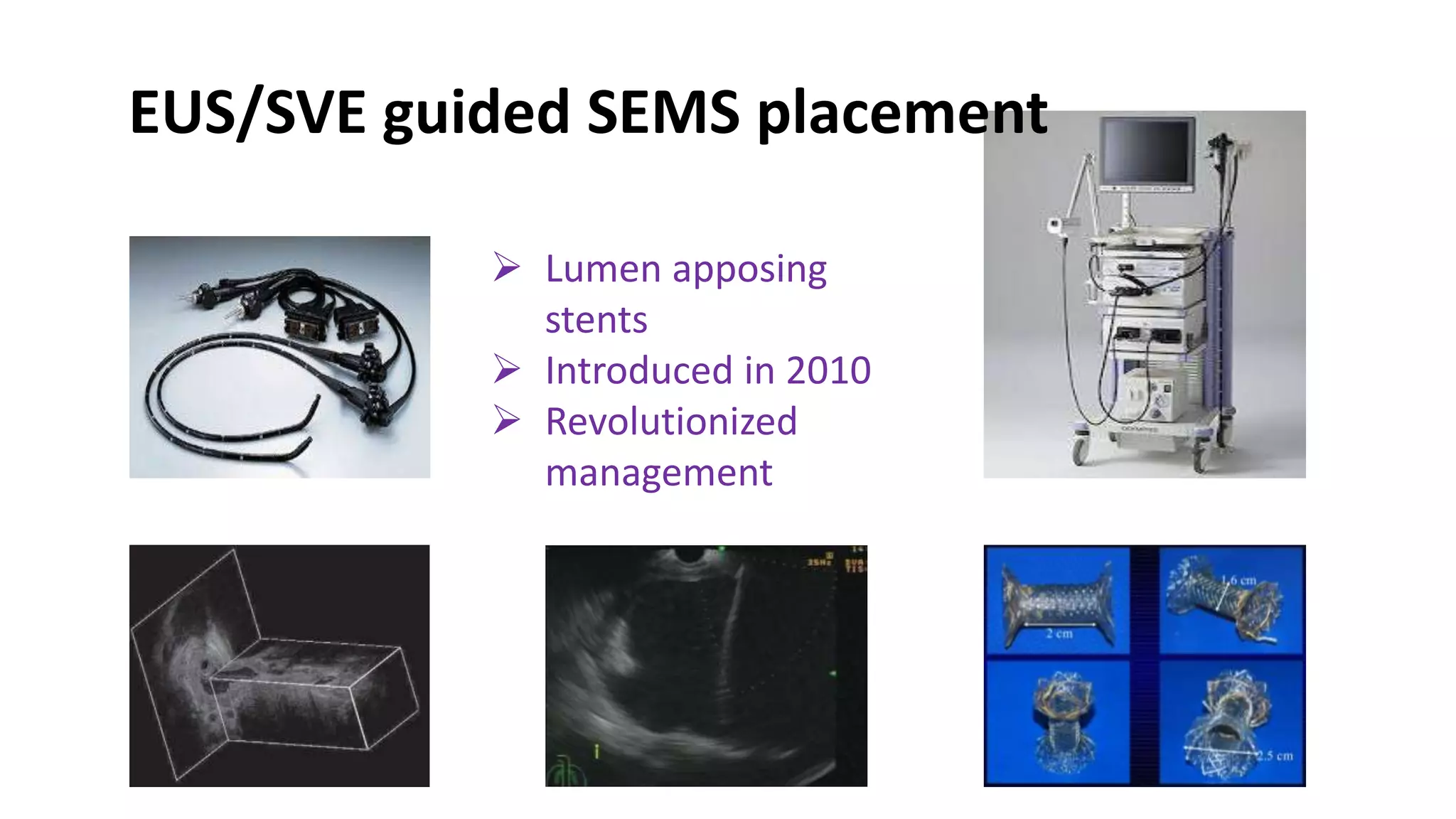 Role of endoscopy in acute pancreatitis presentation --- | PPTX