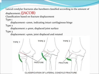 Final final madhu sir | PPT