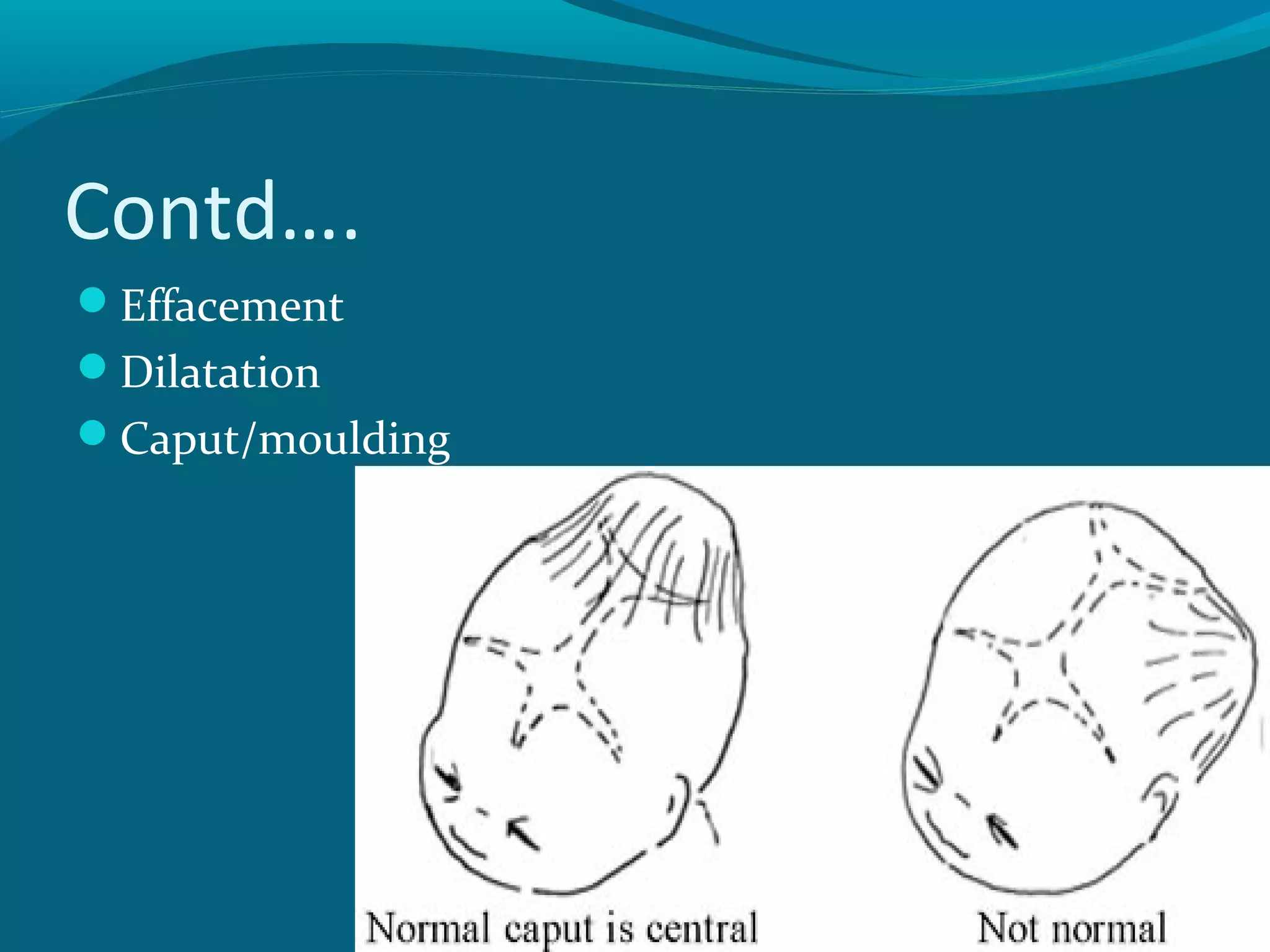Final first stage of labour | PPT