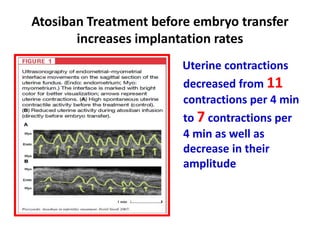 Role of Atosiban In ART Dr. Jyoti Agarwal | PPTX