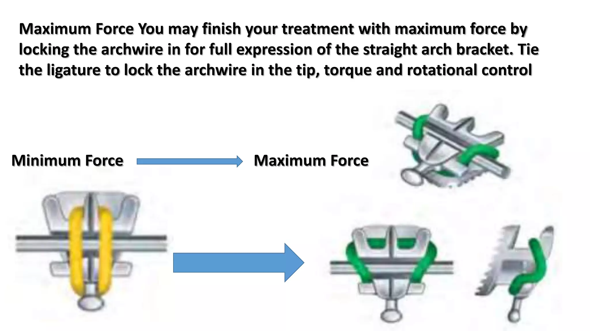 Methods of ligation | PPTX