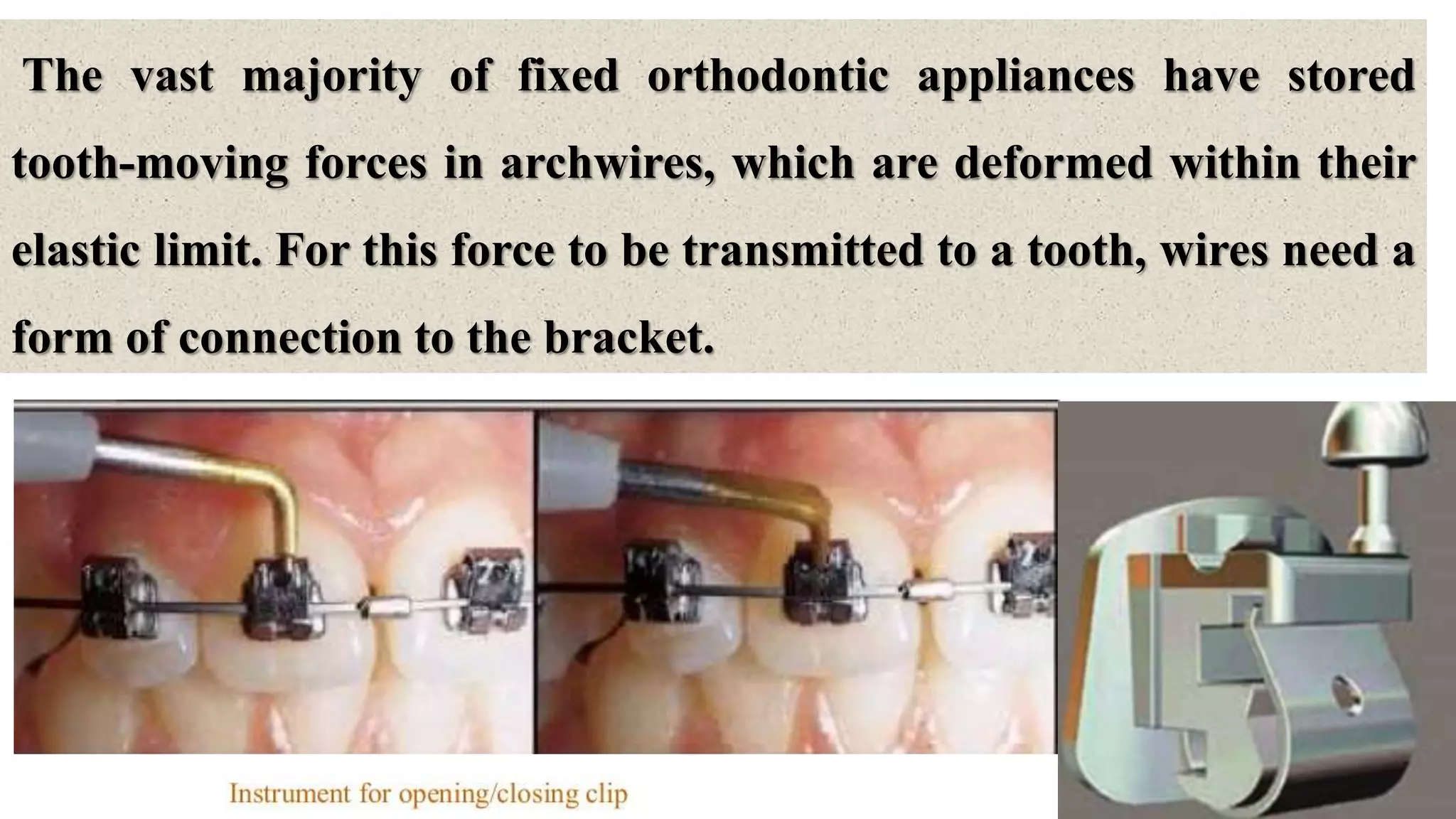 Methods of ligation | PPTX | Oral care | Personal Care