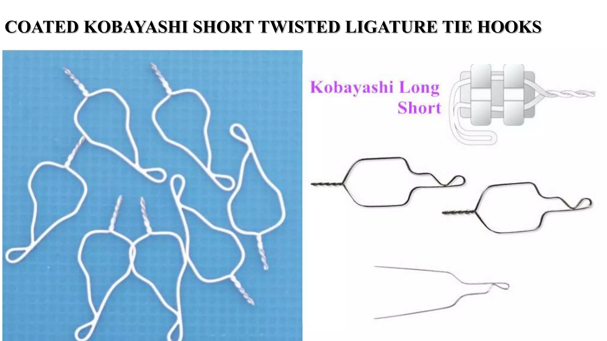 Methods of ligation | PPTX