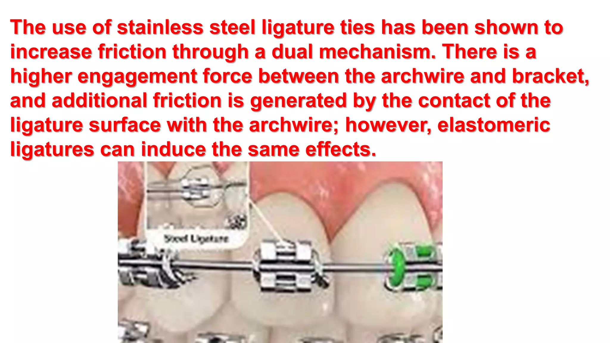 Methods of ligation | PPTX