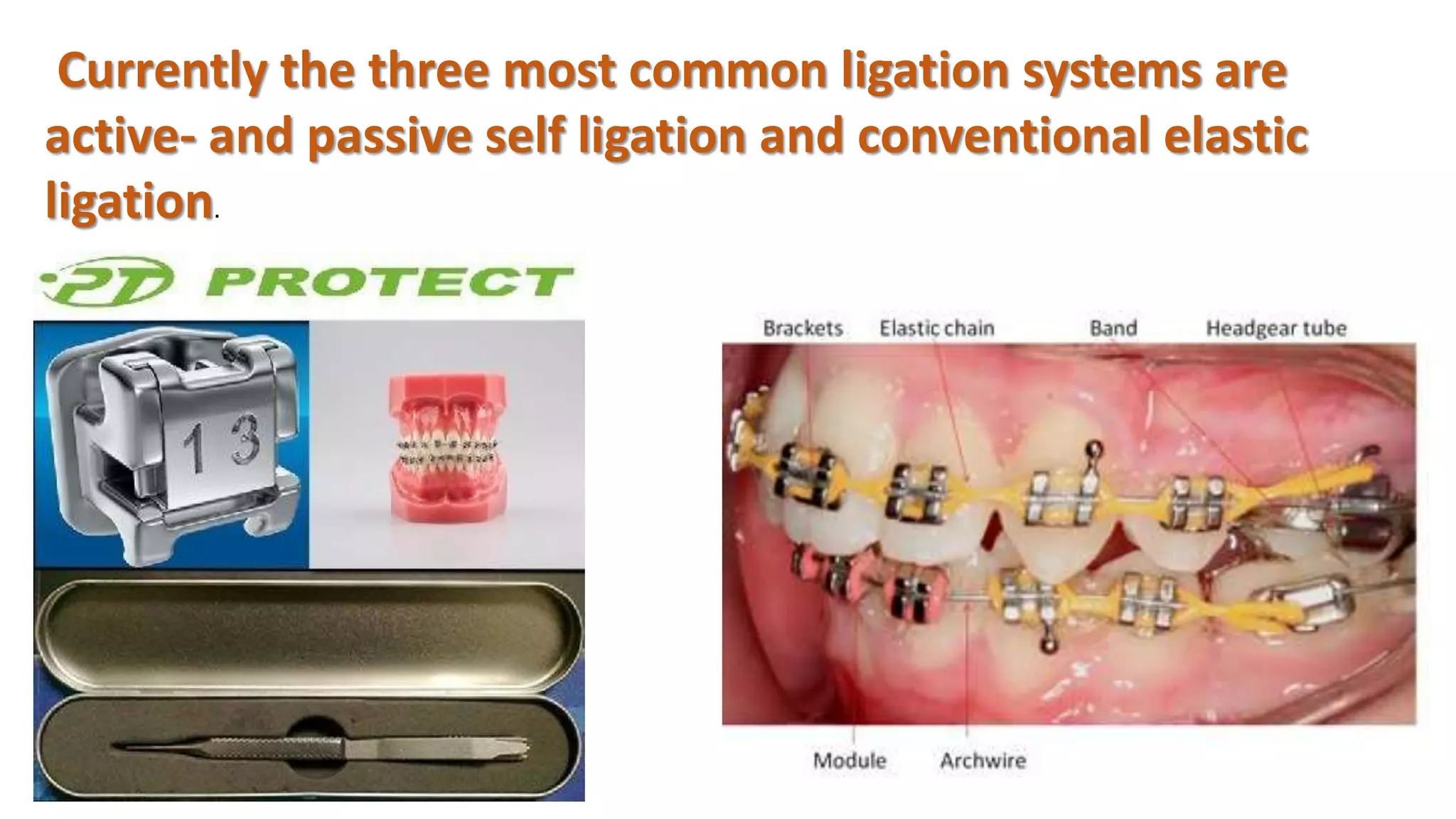Methods of ligation | PPTX