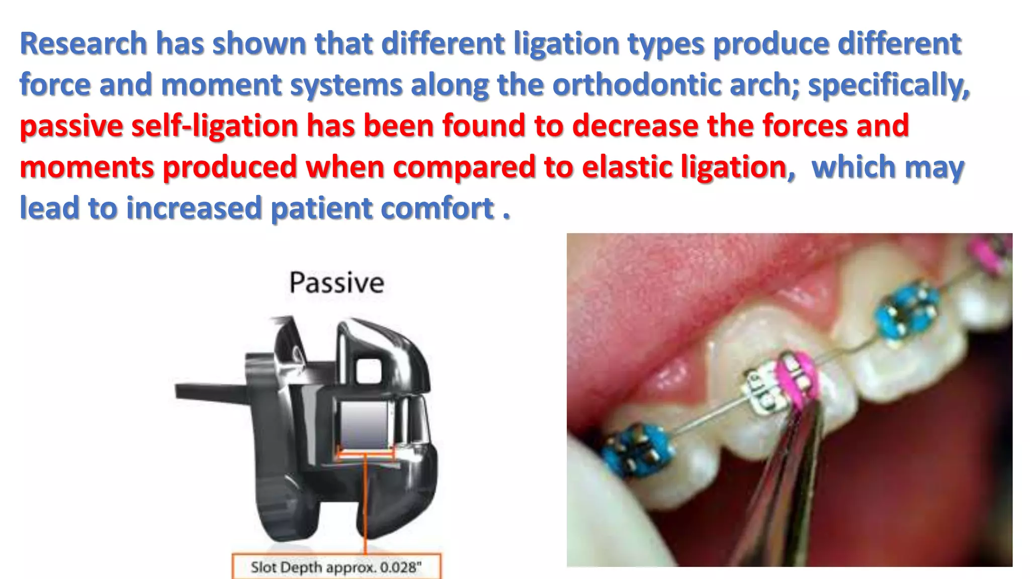 Methods of ligation | PPTX