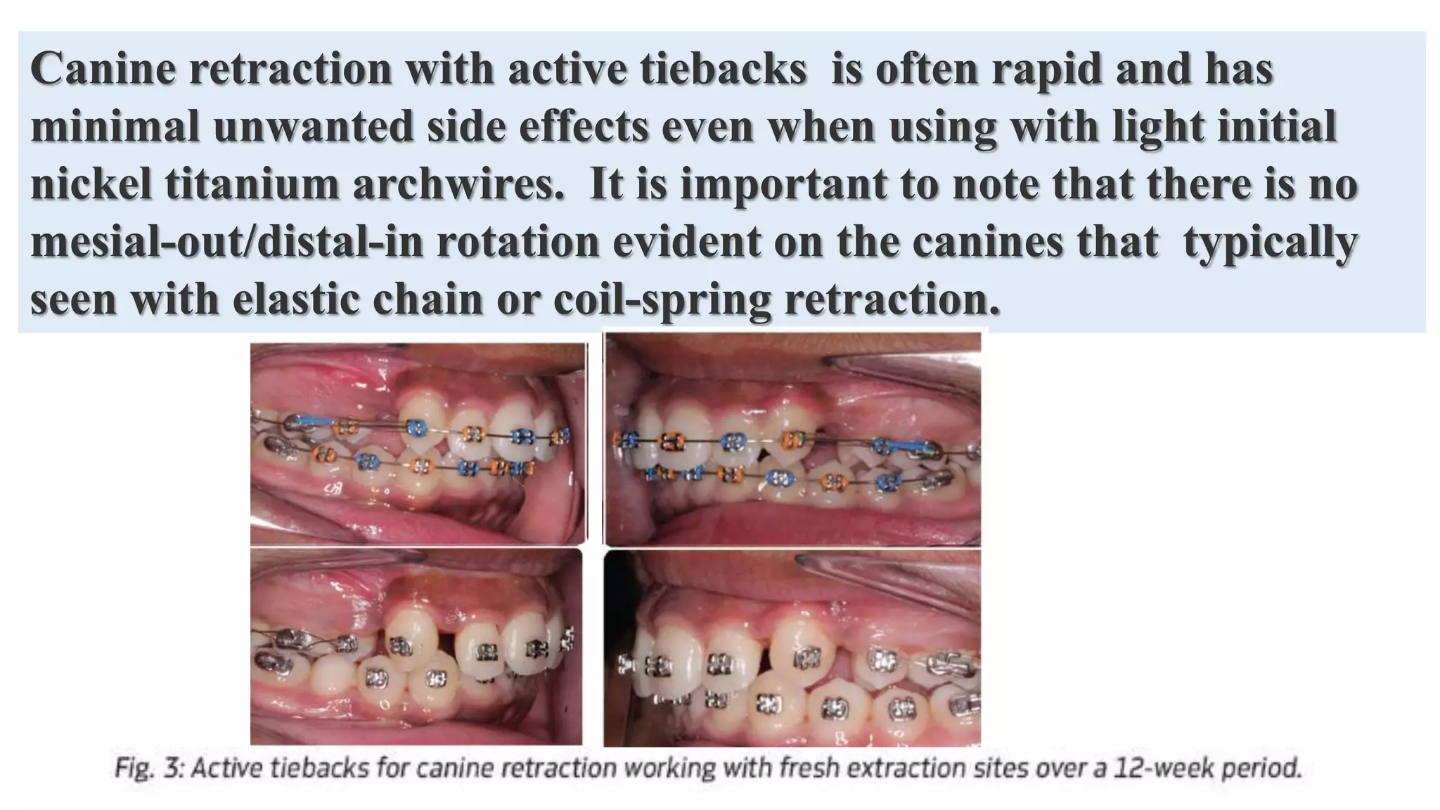 Methods of ligation | PPTX