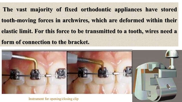 Methods of ligation | PPTX | Oral care | Personal Care