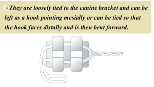 Methods of ligation | PPTX | Oral care | Personal Care