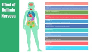 Eating Disorder | PDF