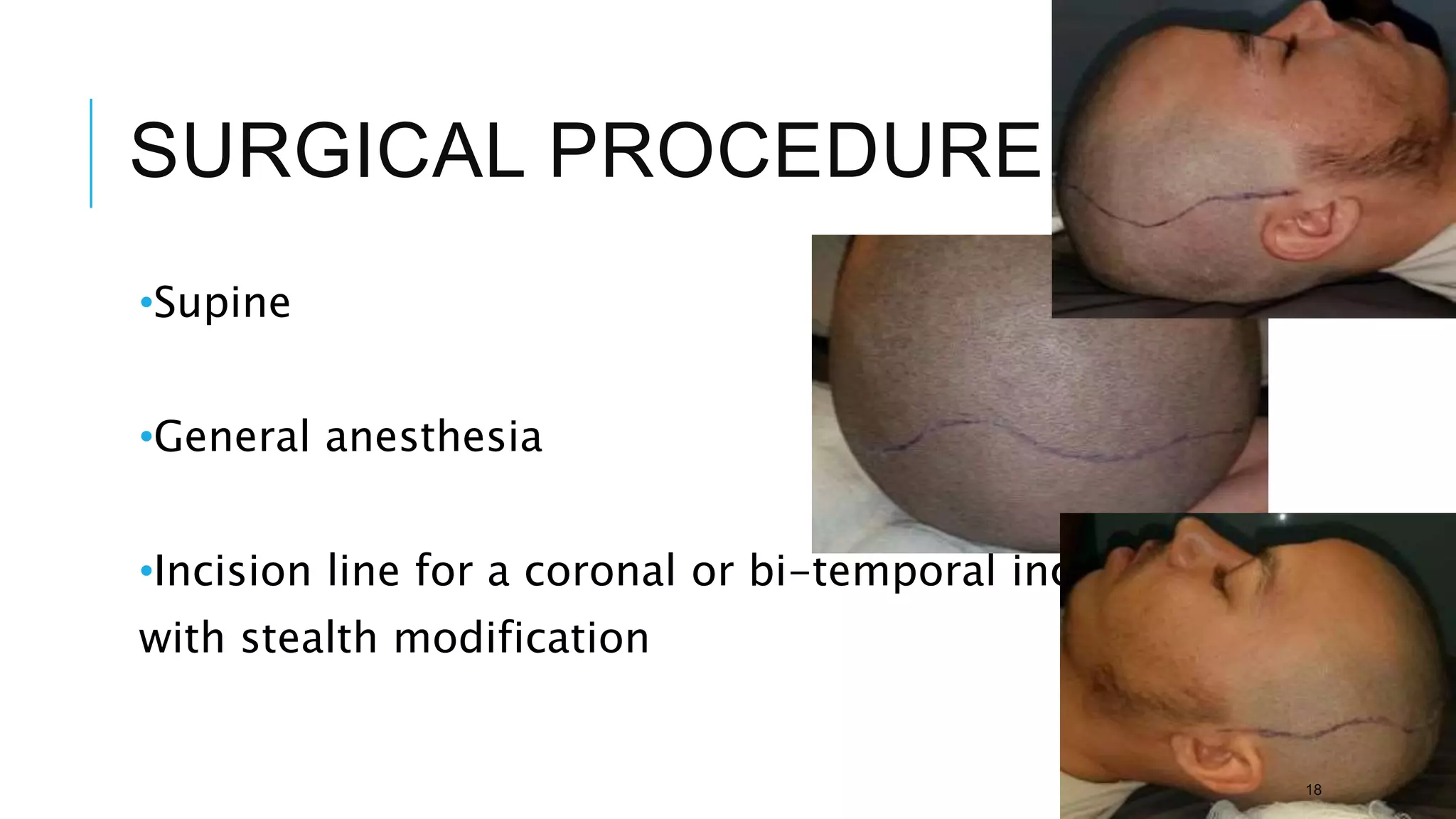 Case report Frontal Bone fracture - Junaid.pptx