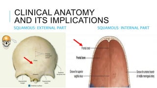 Case report Frontal Bone fracture - Junaid.pptx