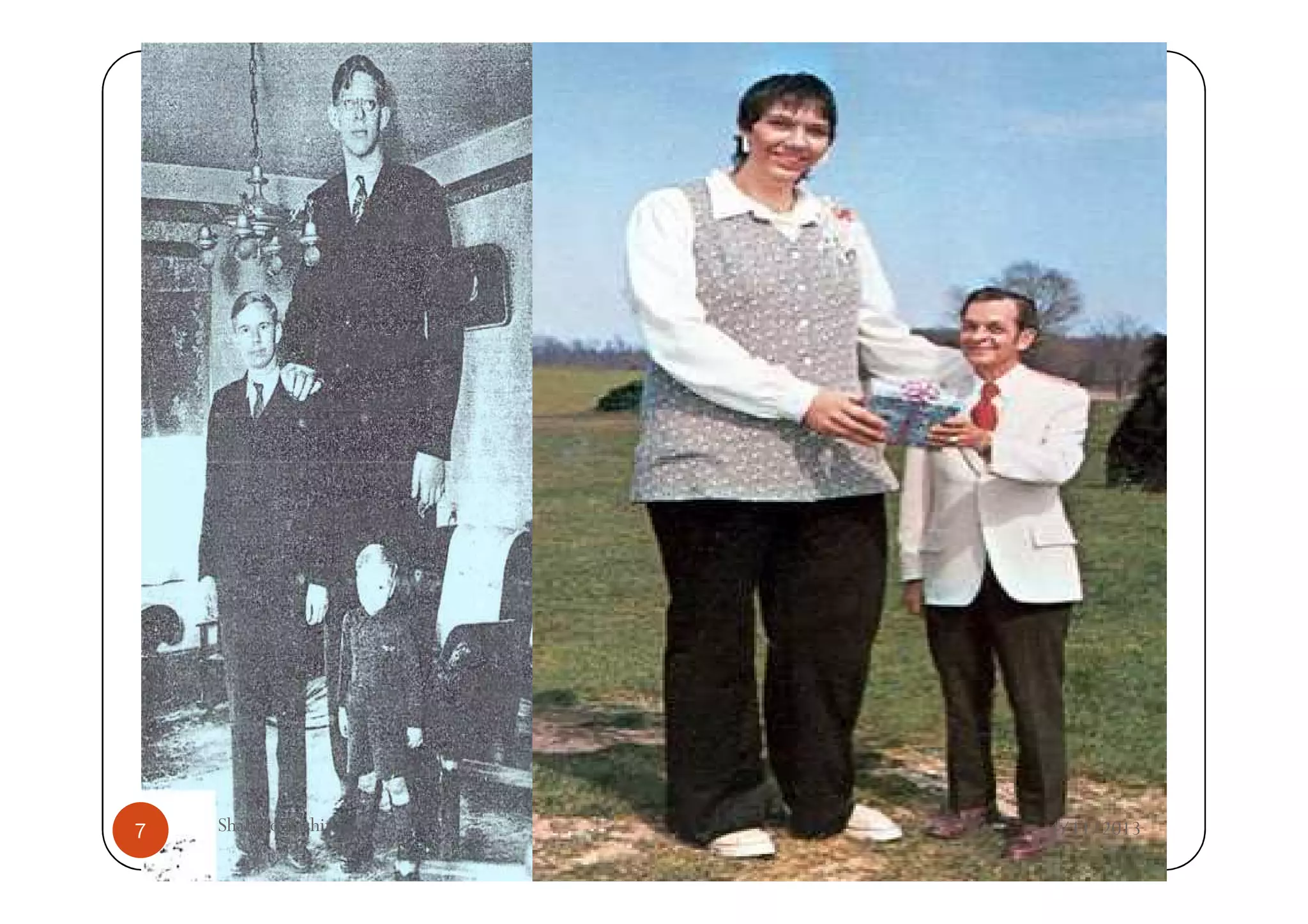 Final gigantism. | PDF